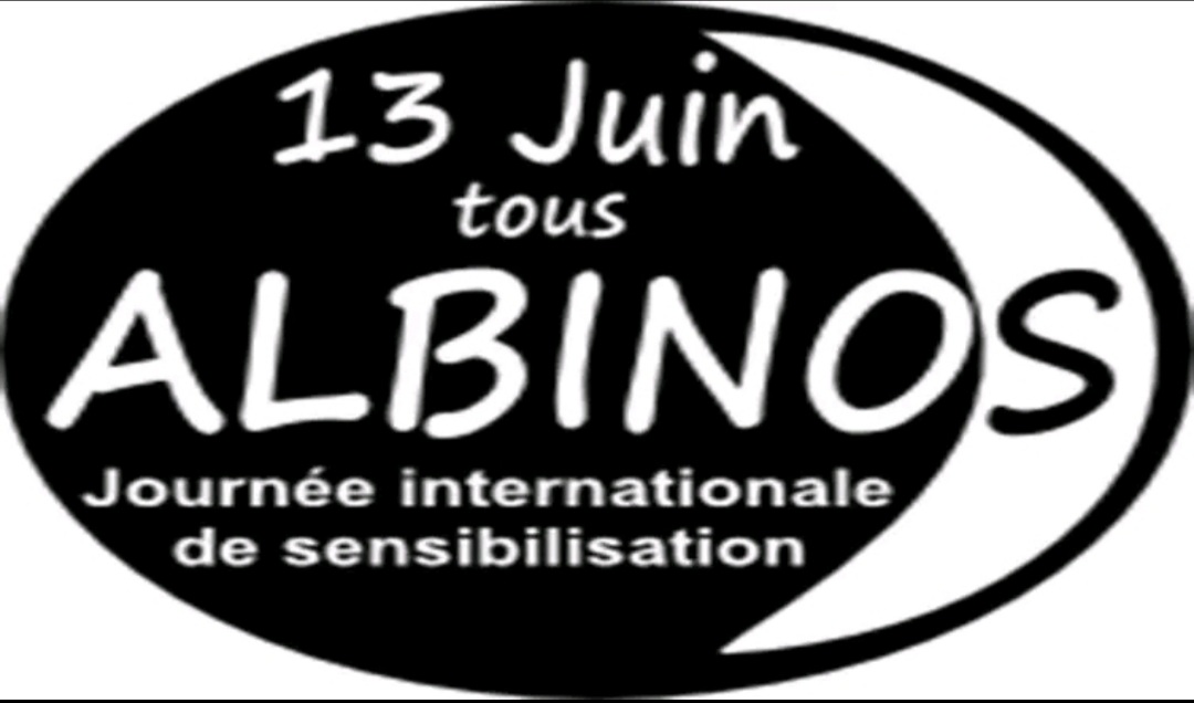 13 Juin: Journée Internationale de Sensibilisation à l'Albinisme
